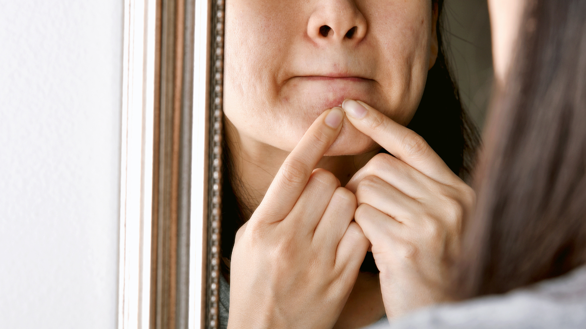 How To Stop Skin Picking | DocVita